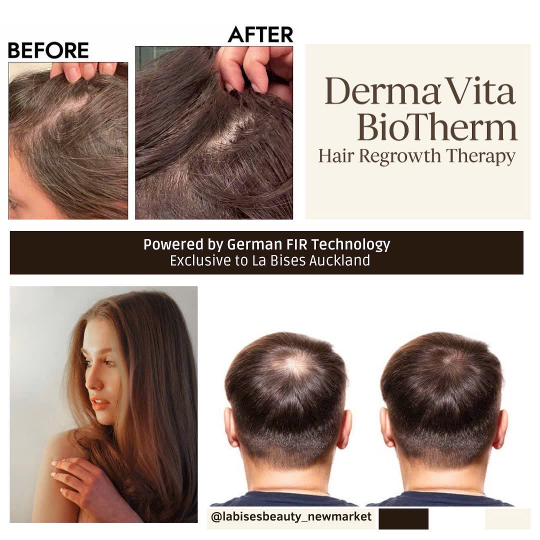 💎 DermaVita BioTherm Hair Regrowth Therapy – Labises Beauty